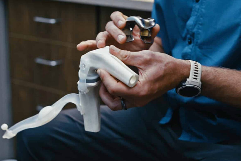 Types Of Knee Replacement Surgeries: A Comprehensive Guide